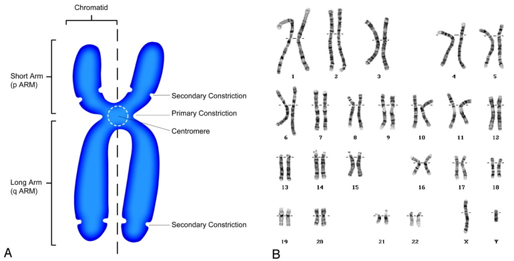 schematic human chromosome : Biological Science Picture Directory ...